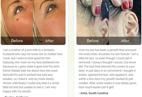 Complete Skincell Pro Mole and Skin Tag Corrector Serum Review ...